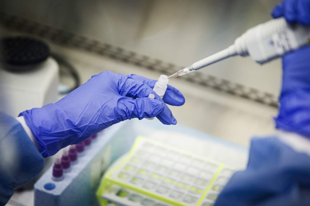 Covid-19 Testing – Yosemite Pathology Medical Group